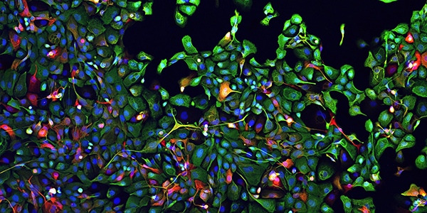 DTU Bioimaging Core